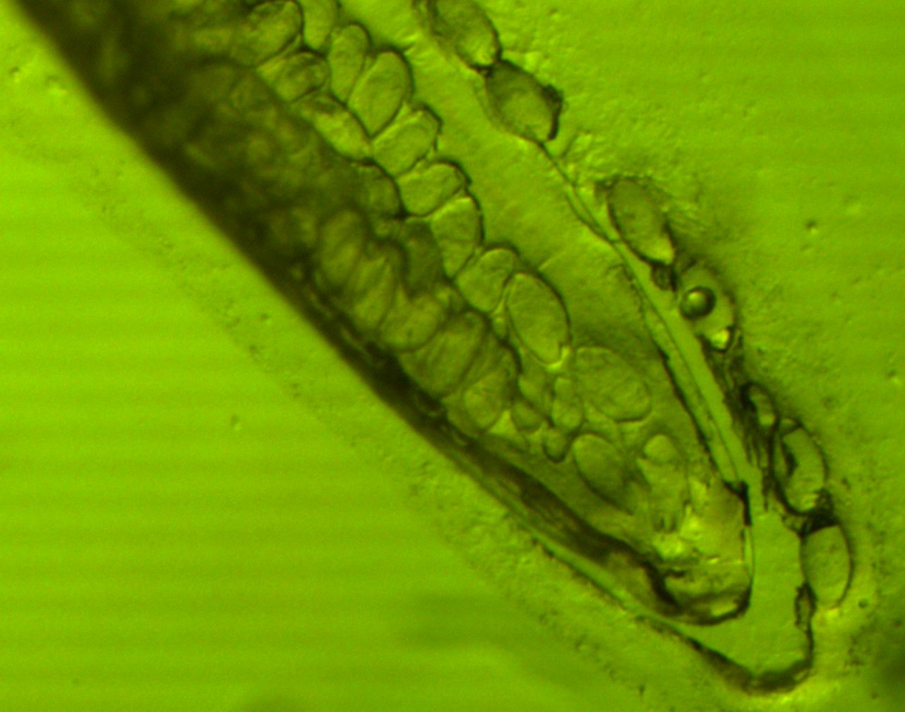 Tail Itching: Pinworm Infestation - Horsemen's Laboratory